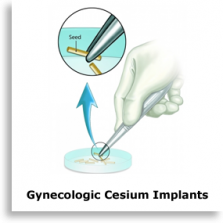 Internal Treatment Options | Central Care Cancer Center